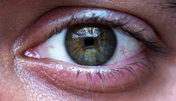 Pink Eye vs. Stye: What’s the Difference?